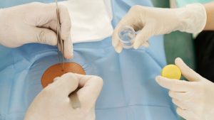 How Fast Can A Melanoma Grow? | Skin Cancer Specialists New