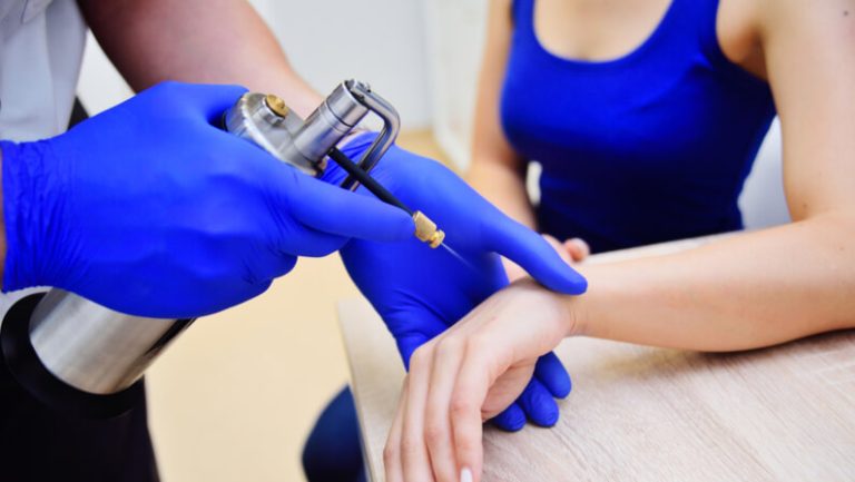 Causes and Treatments of Stucco Keratosis Skin Condition